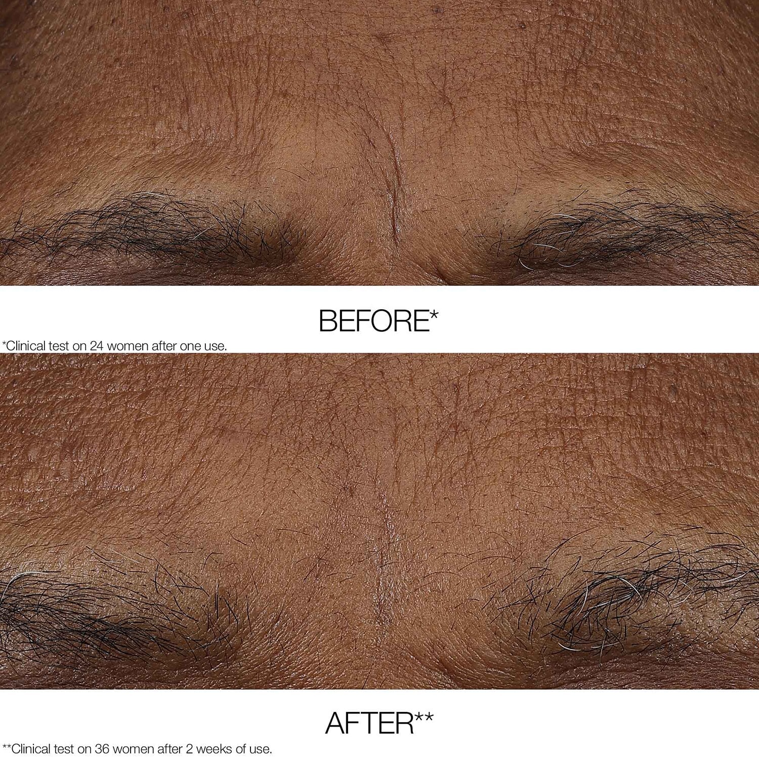 Clinique Smart Clinical Repair™ - AM/PM Retinoid Balm CLINIQUE ≡ SEPHORA